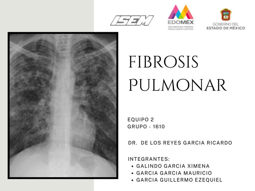 Fibrosis Pulmonar | Mauricio Garcia Garcia | uDocz