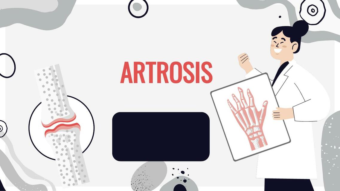 Artrosis | Angeles Villa | uDocz