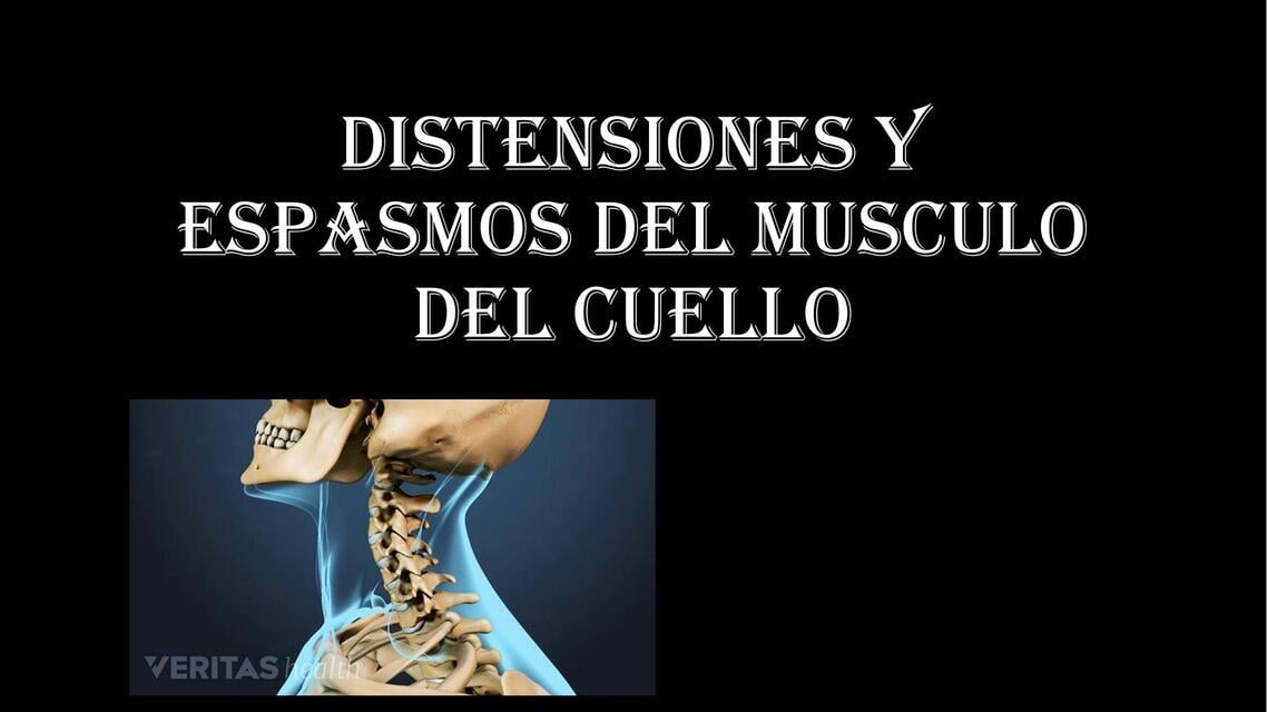 Distensiones y espasmos del musculo del cuello | Favio Villasante | uDocz