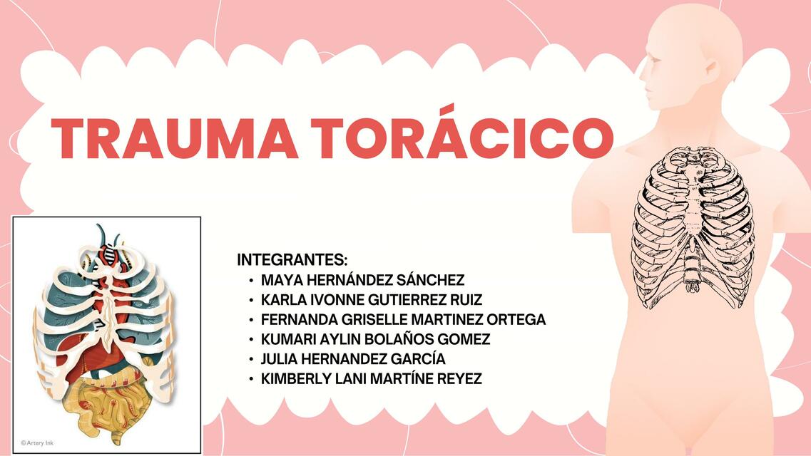 Trauma Torácico | KAREN ALEXANDRA MARTINEZ REYES | uDocz
