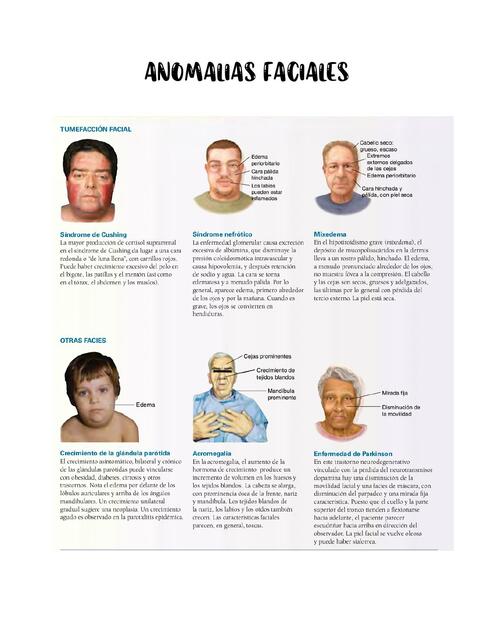 ANOMALIAS CABEZA Y CARA Y DEFECTOS DE CAMPOS VISUALES | Zoe Mandujano ...