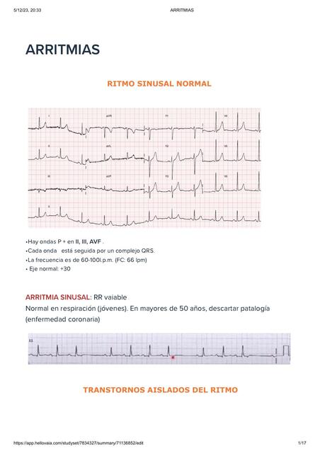 Arritmias | Arthur Vargas | uDocz