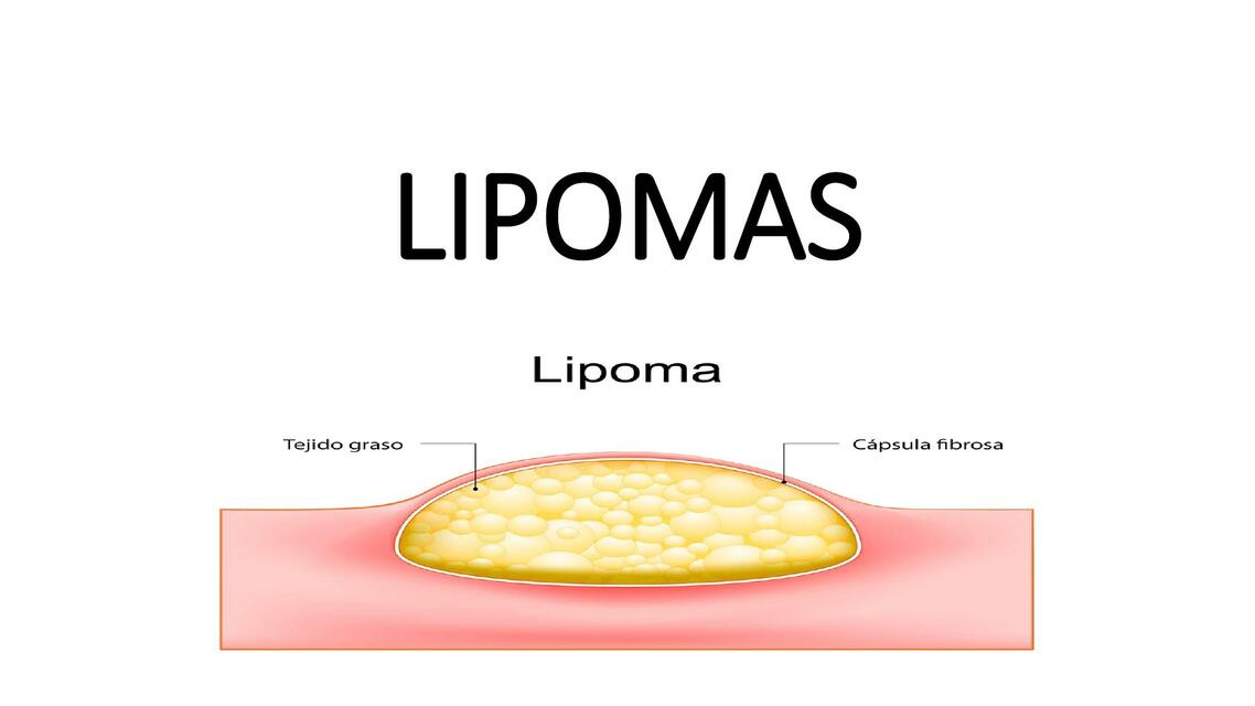 LIPOSOMAS | Alquimia- Nurse | uDocz