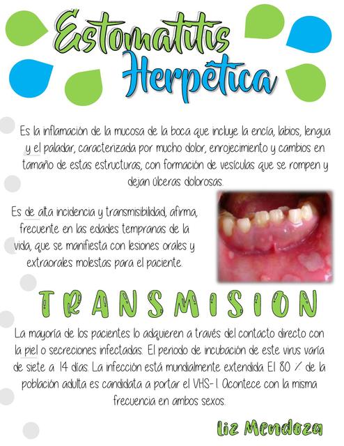 ESTOMATITIS HERPETICA