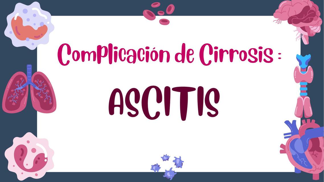 Complicación de Cirrosis: Ascitis | Josselin Choquehuanca Muñoz | uDocz