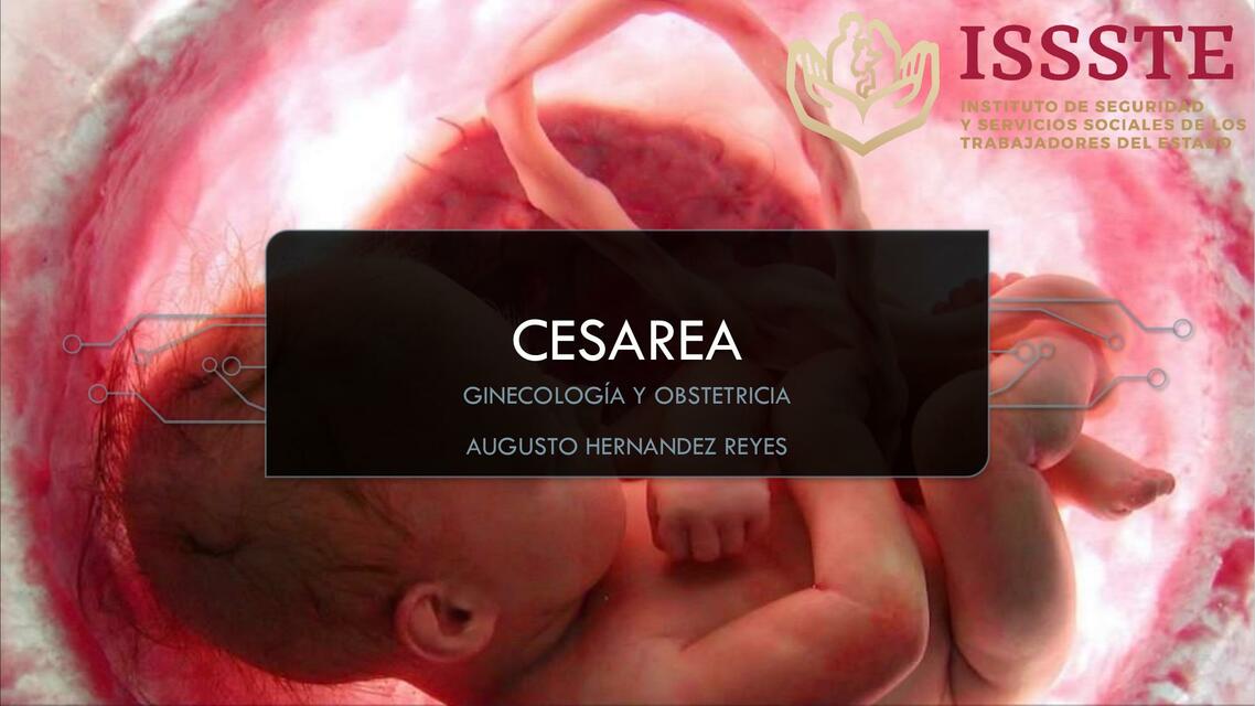 Cesárea | Dr Gus | uDocz