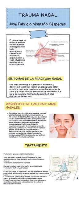 Trauma nasal | José Fabricio Montaño Céspedes | uDocz