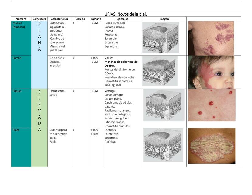 Tipos de lesión | Melina Nicole Astorga Ramirez | uDocz