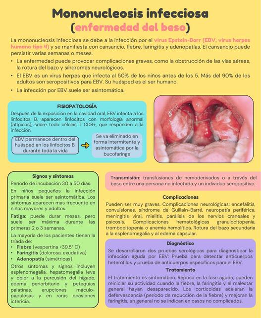 Mononucleosis infecciosa - Enfermedad del beso | Javier Rios | uDocz