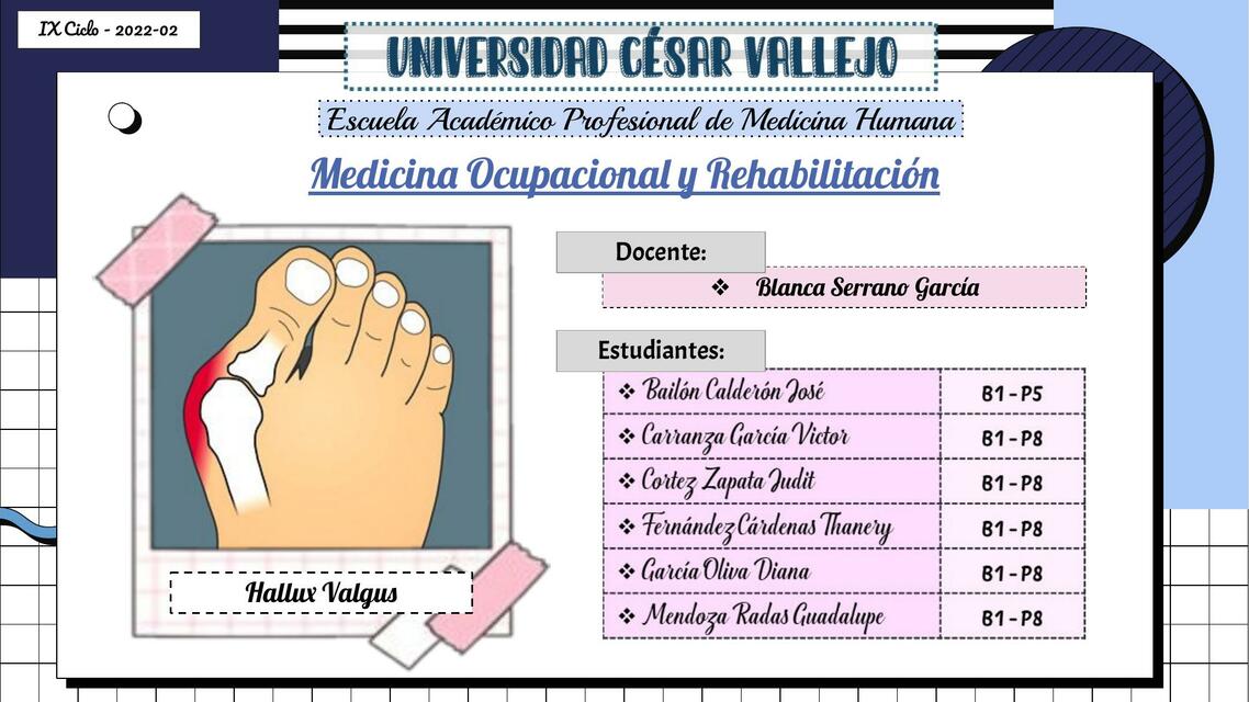 HALLUX VALGUS | Guadalupe Mendoza Radas | uDocz