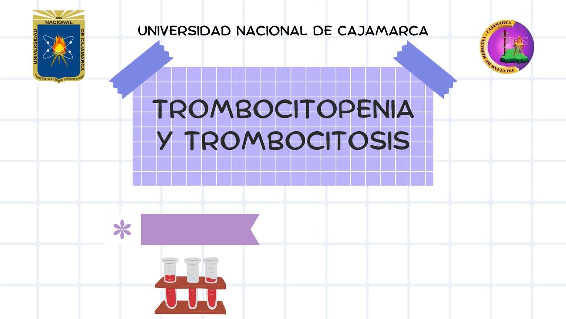 Trombocitopenia y trombocitosis | F.E.D | uDocz