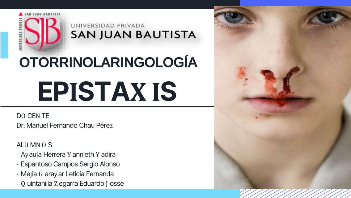 Epistaxis | Kiara Huamaní Avalos | uDocz