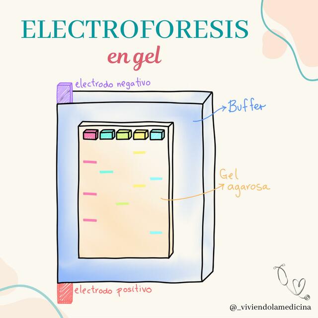 Electroforesis en gel | Viviendo la medicina | uDocz