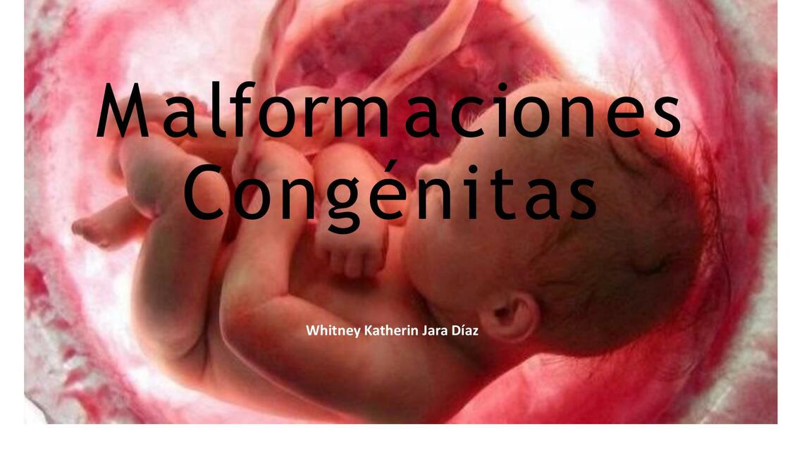 malforamaciones congenitas en recien nacidos | Henry Maldonado ...
