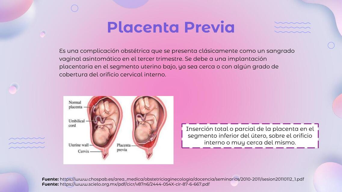 Placenta previa | Escuela medica | uDocz