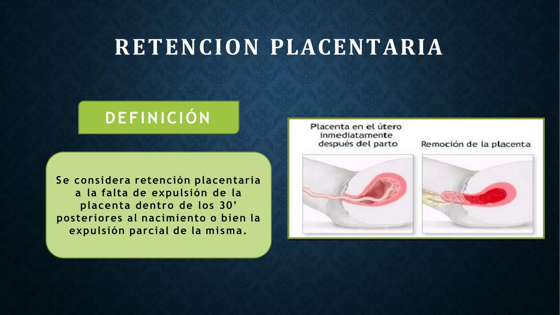 Retención Placentaria | Henry Maldonado Gutiérrez | uDocz