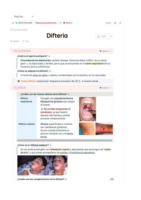 Difteria | Anaiz Ticona Flores | uDocz