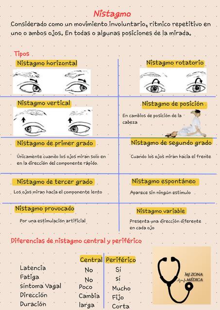 Tipos de nistagmo | Mizonamédica | uDocz