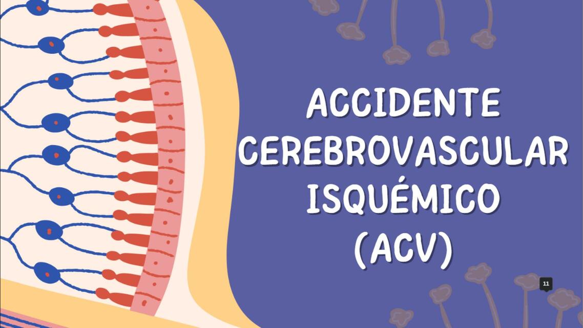 Accidente Cerebrovascular Isquémico - ACV | Josselin Choquehuanca Muñoz ...