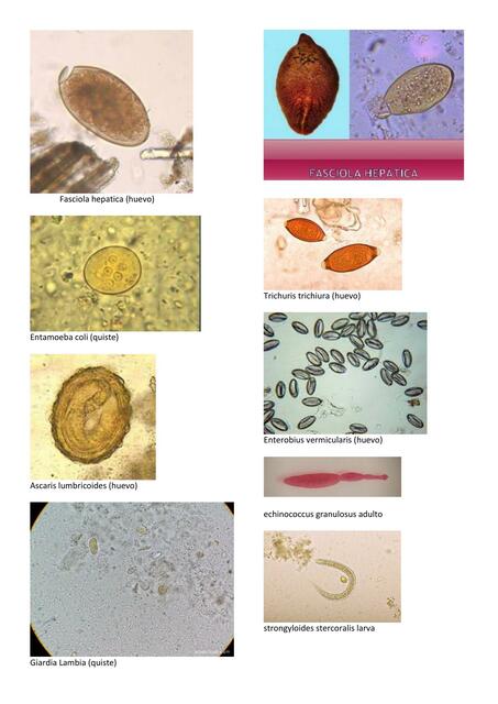 Fasciola hepatica | Heidi Solano | uDocz