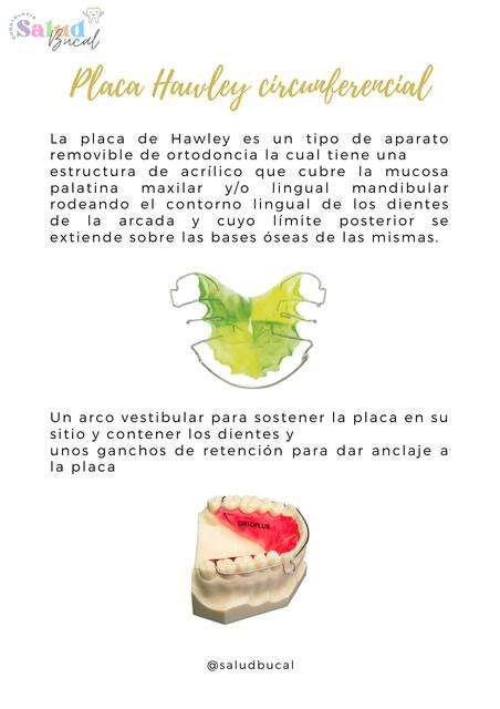 Placa hawley circunferencial | Salud bucal | uDocz