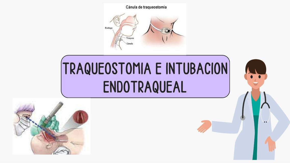 Traqueostomía e intubación endotraqueal | Aida NursNotes | uDocz