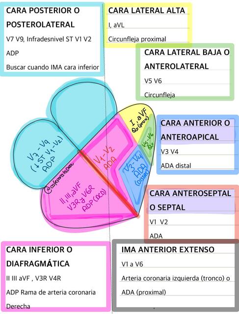 CARDIOLOGIA: EKG: INFARTO AGUDO MIOCARDIO: CARAS Y ARTERIAS AFECTADAS ...