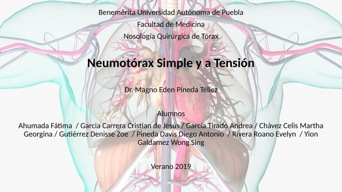 Neumotórax Simple y a Tensión | norman mariano gonzalez garcia | uDocz