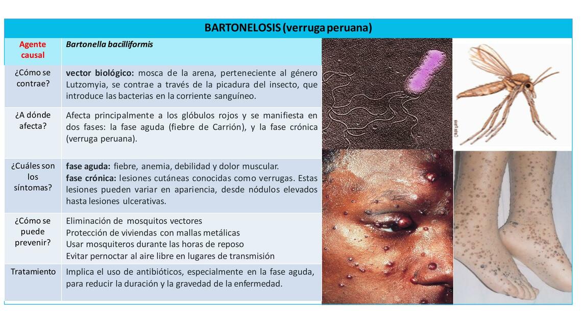 BARTONELOSIS | Full ciencia | uDocz