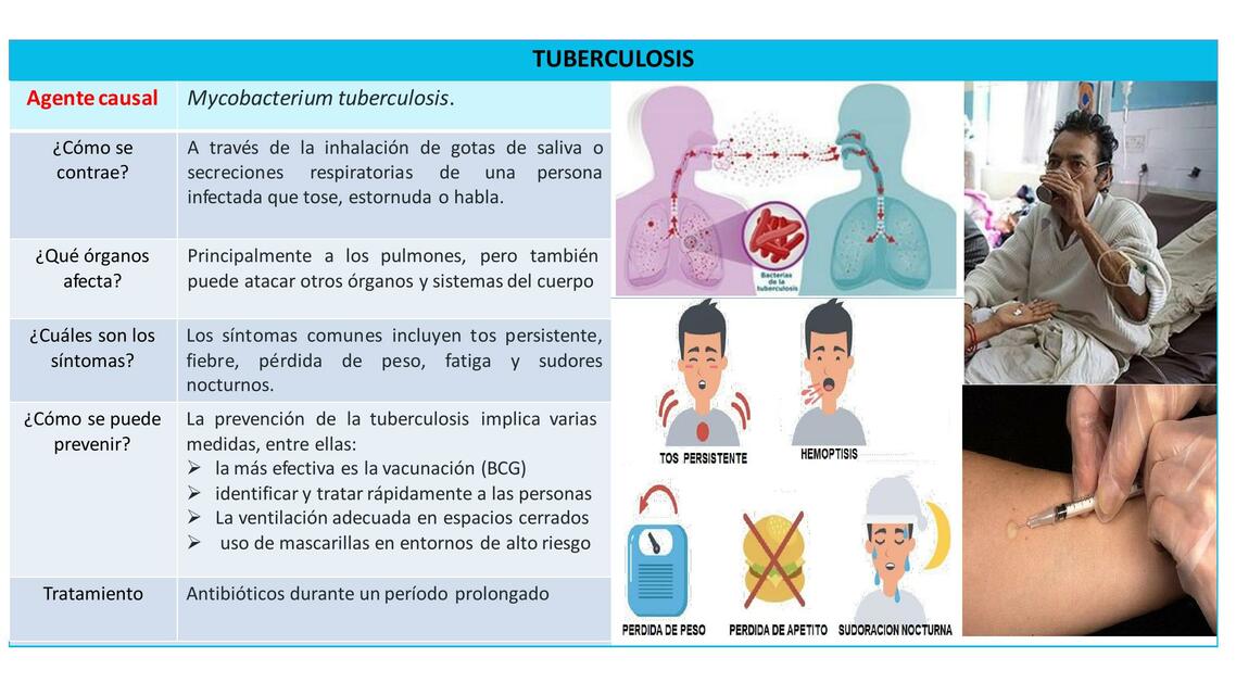 TUBERCULOSIS | Full ciencia | uDocz