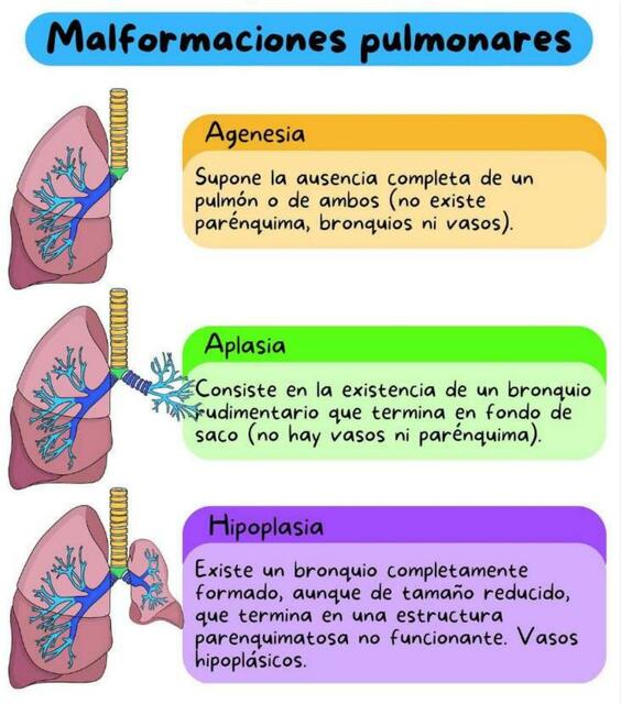 Malformaciones pulmonares | YUDOC.ORG | uDocz