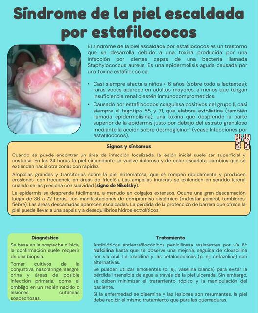 Síndrome de la piel escaldada por estafilococos | Javier Rios | uDocz