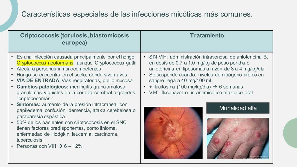 Características especiales de las infecciones micóticas | Doctor_teco ...