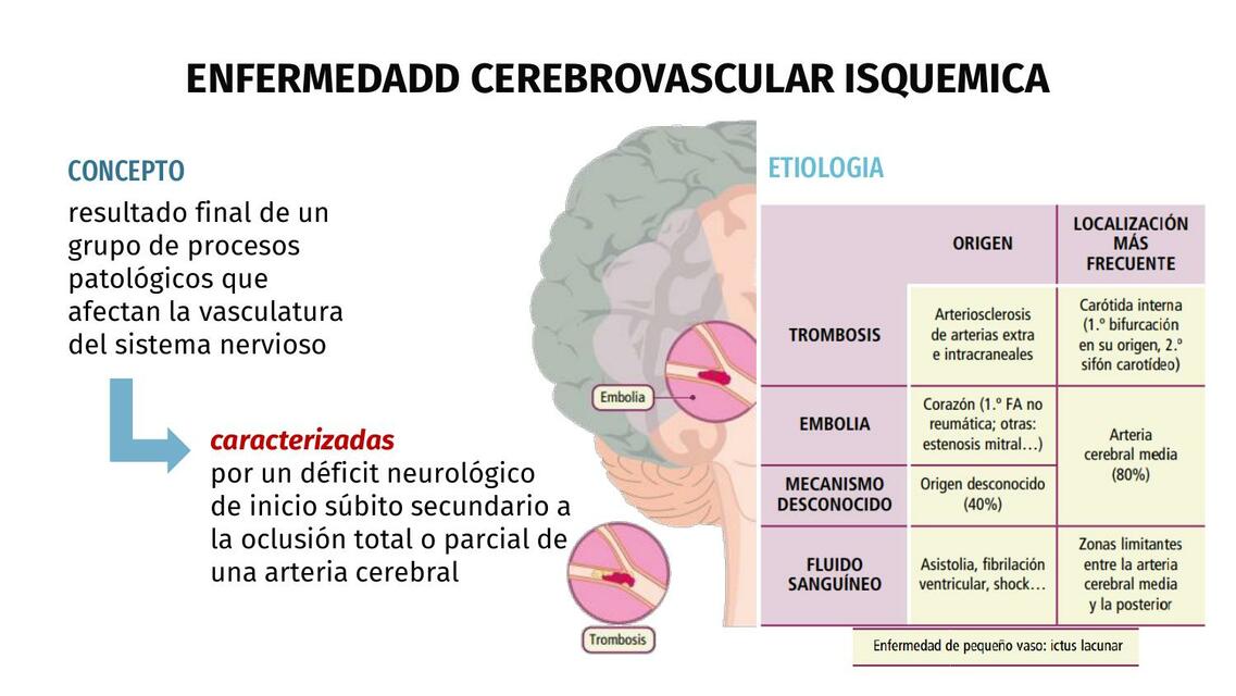 Enfermedad cerebrovascular isquémica | Doctor_teco | uDocz