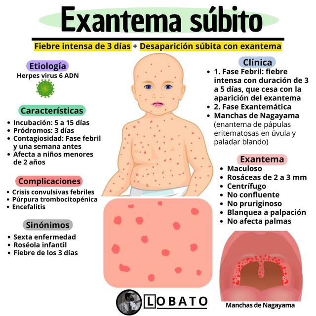Exantema súbito, Roséola, Sexta enfermedad 🩺| Exantemas Pediatría ...