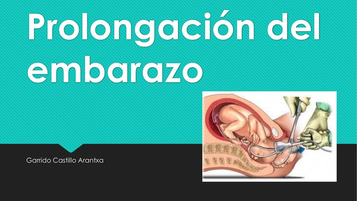 parto postermino | FitMed | uDocz