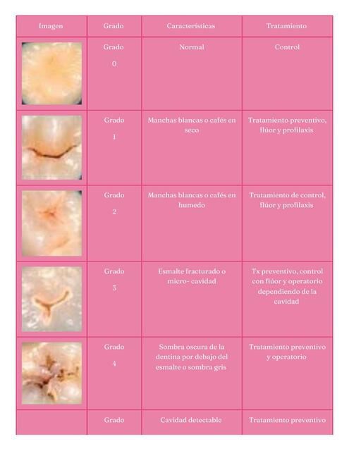 Grado de Caries | Andrea Aguilar | uDocz
