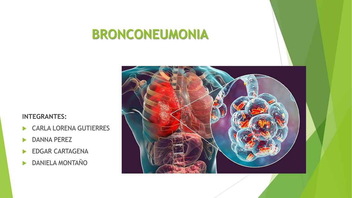 Bronconeumonía | Fausto Fernández | uDocz