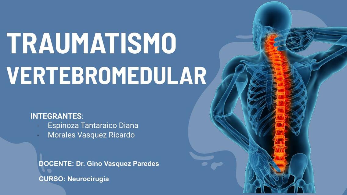 Traumatismo Vertebromedular | Diana Espinoza | uDocz