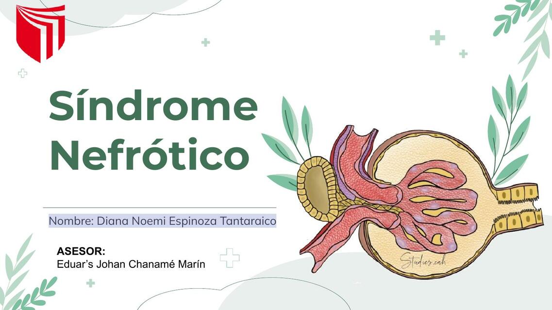 Síndrome nefrótico | Diana Espinoza | uDocz