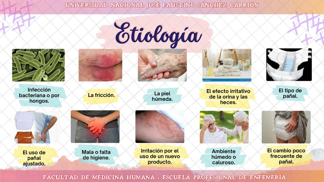 Etiología de la dermatitis | MARLEY ROSALIND ELIZAMA VERA BARRETO | uDocz