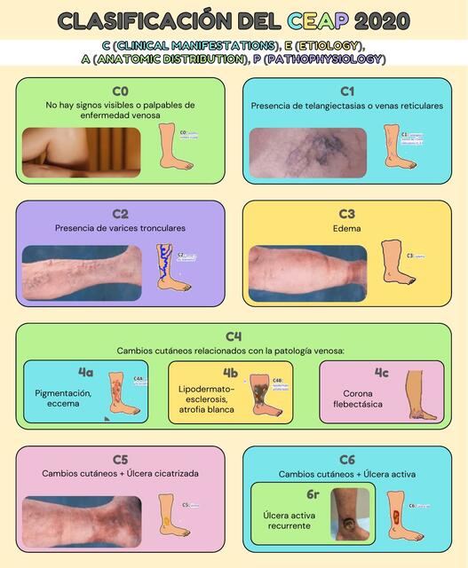 Escala CEAP insuficiencia venosa cronica | Javier Rios | uDocz