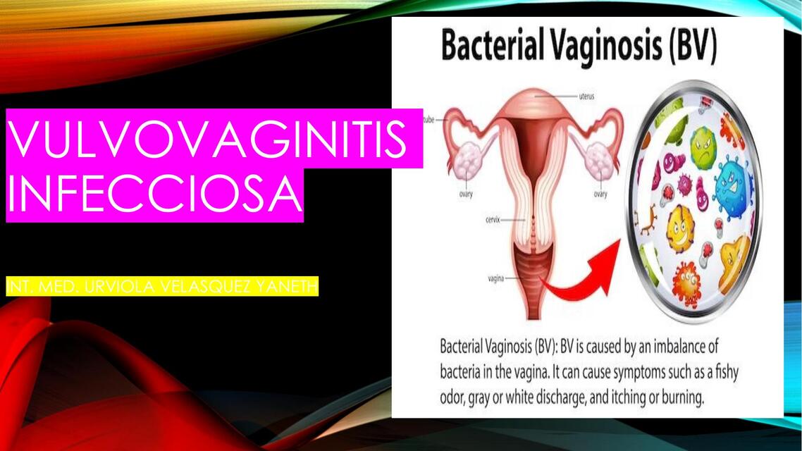 Vulvovaginitis infecciosa | YANETH URVIOLA VELASQUEZ | uDocz