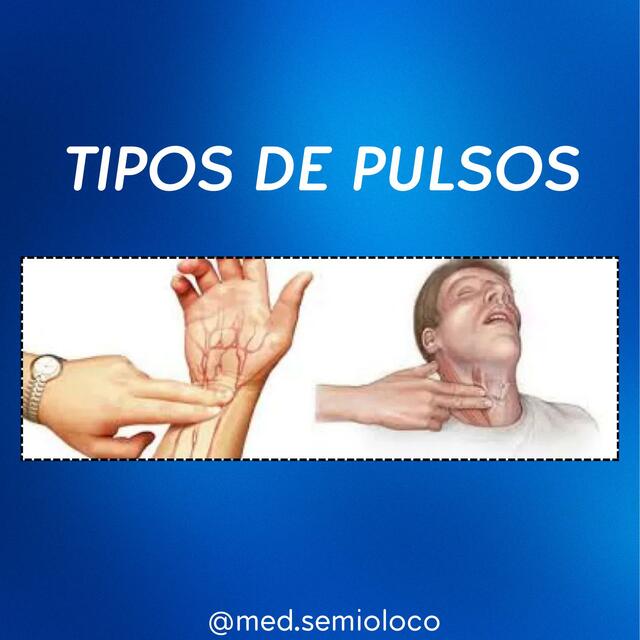 Tipos de Pulsos | Víctor Rodriguez Botero - @med.semioloco | uDocz