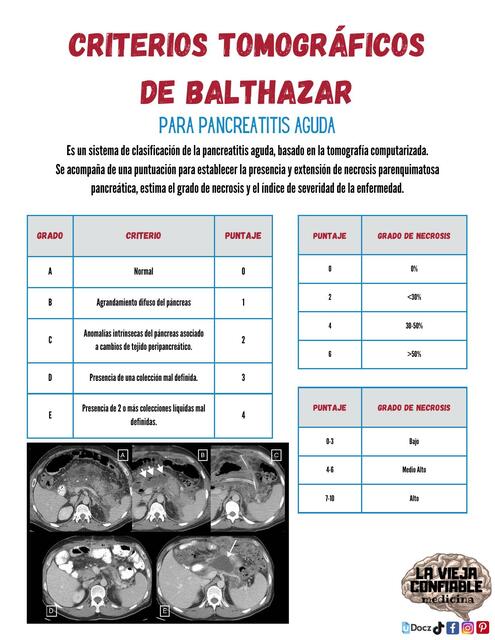 Criterios Tomográficos de Balthazar | CEREBROS MEDICOS | uDocz