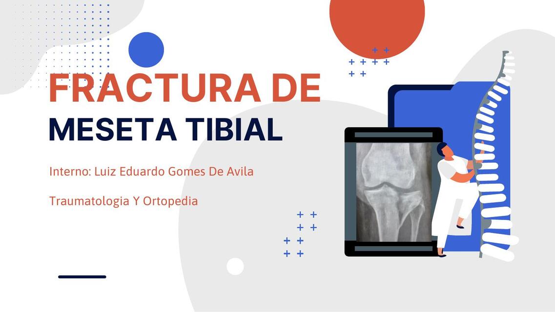 Fractura de meseta tibial | Luiz Eduardo Gomes de Avila | uDocz