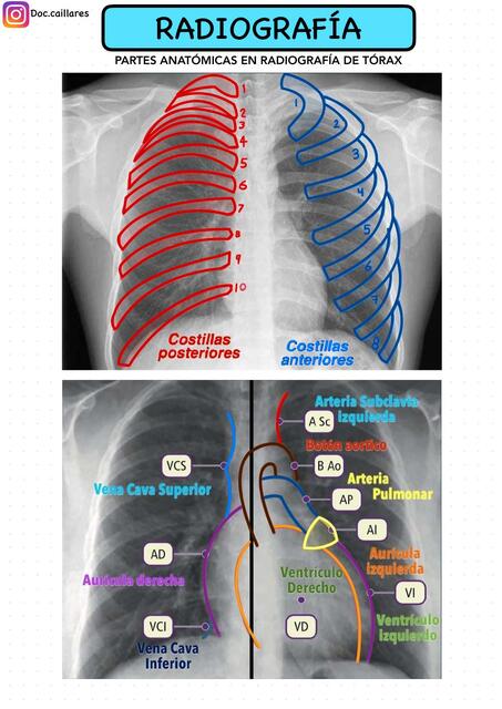 RADIOGRAFÍA ANATOMÍA TÓRAX | Dr. Boris Moises Caillares Montaño | uDocz