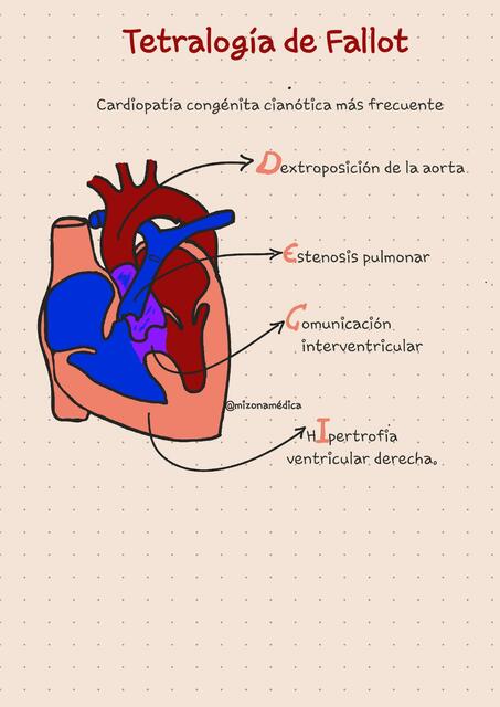 Tetralogia de Fallot | Mizonamédica | uDocz
