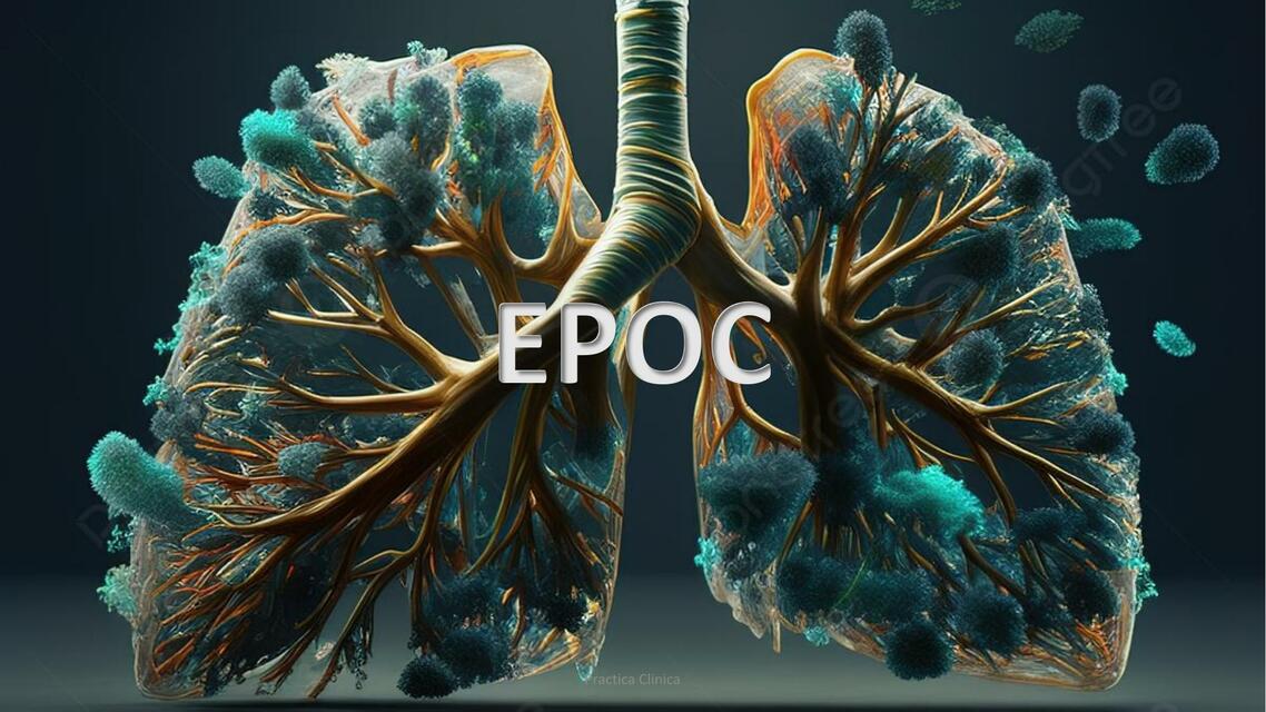 EPOC | GLORIA | uDocz