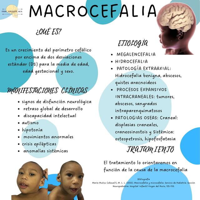 Macrocefalia | Fisio.Ada | uDocz